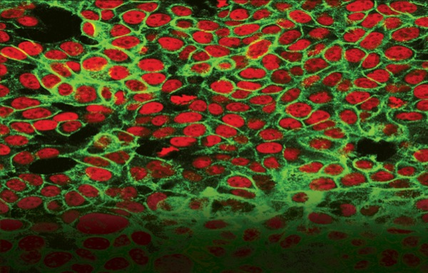 ‘Patient-Friendly’ Stool Test for CRC Performs in Study ‘Patient-Friendly’ Stool Test for CRC Performs in Study
