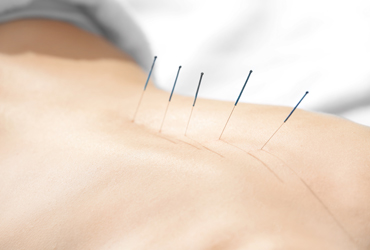 Acupuncture Reduces AI-Associated Joint Pain