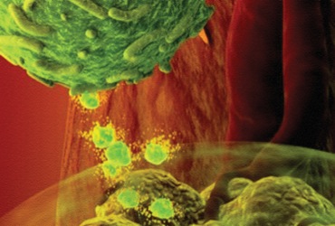 Immunotherapy Toxicities: Early Recognition and Management