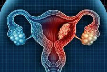 Keytruda Approved to Treat PD-L1-Positive Cervical Cancer
