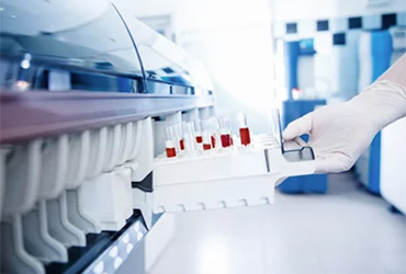 ctDNA Test Highly Accurate in Detecting Early-Stage Colorectal Cancer