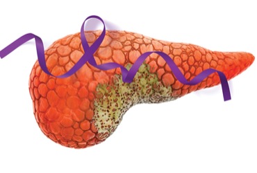New ASGE Guidelines on Pancreatic Cancer Screening