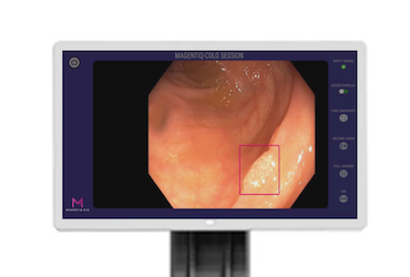 FDA OKs Software to Detect GI Lesions With Artificial Intelligence